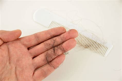 Why Is Your Hair Falling Out Malefemale Guide