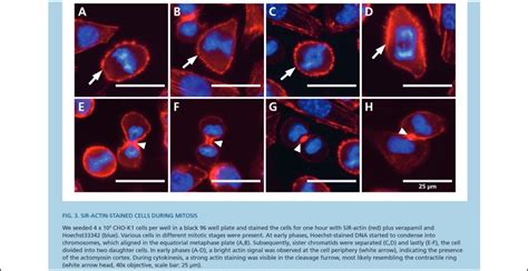 Andrew Ondřej Kalous On Linkedin Live Cell Imaging Of The Actin