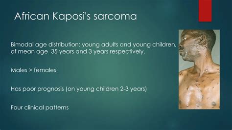 Kaposis Sarcoma Medicine And Surgery Ppt Pptx