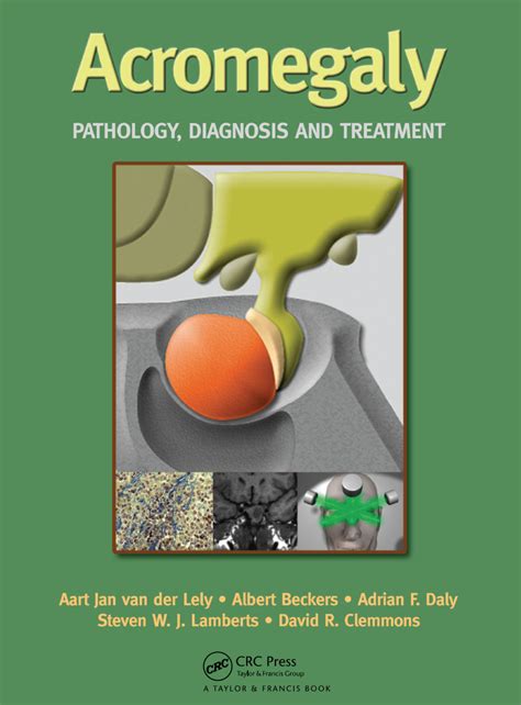 Acromegaly Pathology Diagnosis And Treatment 1st Edition Premiumjs Store