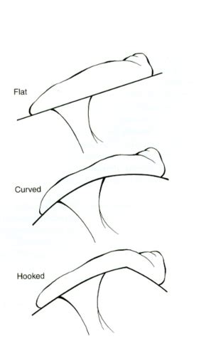 Rotator Cuff Pathology Flashcards Quizlet