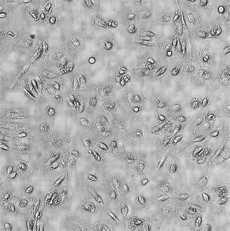 matlab improving low contrast image segmentation stack overflow