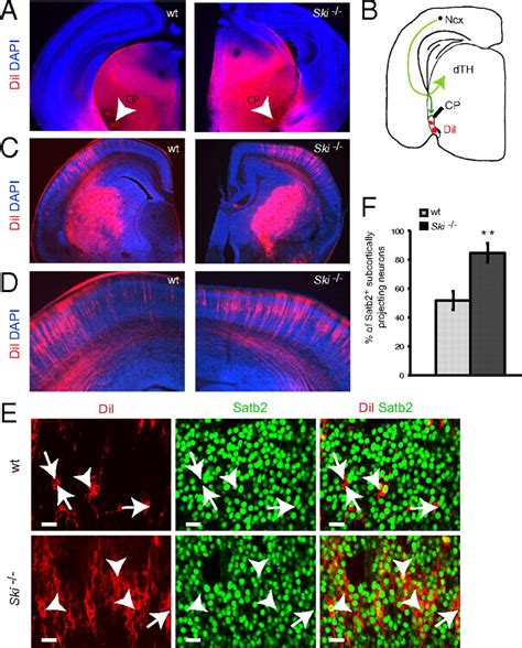 Protooncogene Ski Cooperates With The Chromatin Remodeling Factor Satb2 In Specifying Callosal