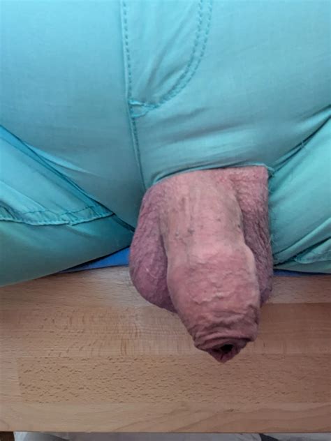 Pants Torn 10 Nude Pics Xhamster