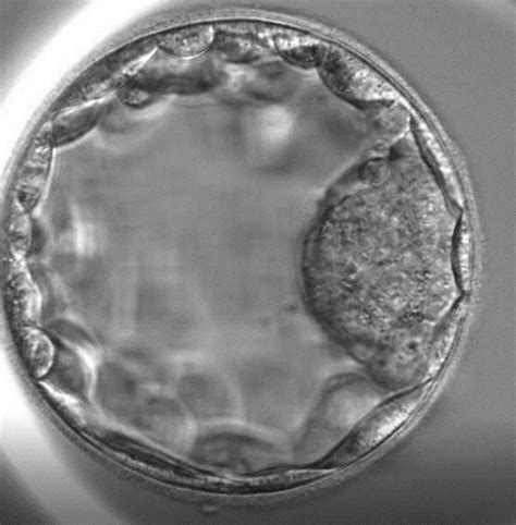 Blastocyst Embryo