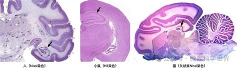 脑海马结构简介 海南省生物材料与医疗器械工程研究中心