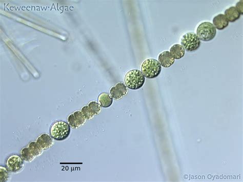 Anabaena Under Microscope Labeled