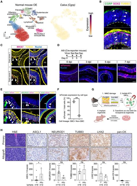 Olfactory Neuroblastoma Mimics Molecular Heterogeneity And Lineage Trajectories Of Small Cell