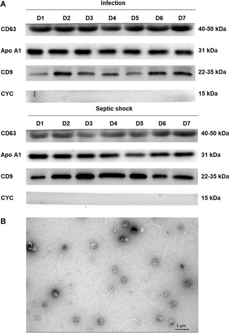 Assessing Extracellular Vesicle Isolates By Western Blot And Electron