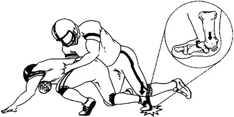 Rehabilitation Following Turf Toe Injury And Plantar Plate Repair