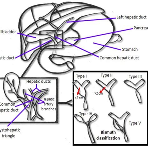 Liver Biliary Tract Anatomy And Bismuth Classification Download Scientific Diagram