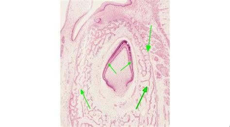 Ossification Flashcards Quizlet