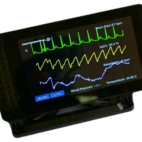 connected health open source iot patient monitor