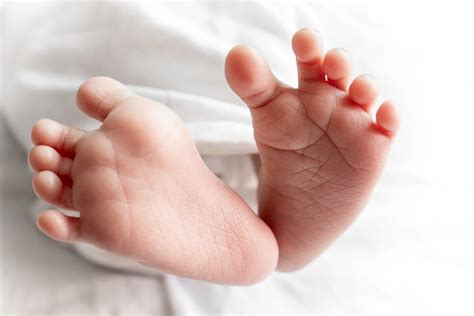 What Is Metatarsus Adductus Bondi Podiatry