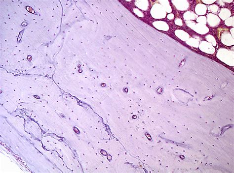 Immature Compact Bone Decalcified Lm Stock Image C030 5070 Science Photo Library