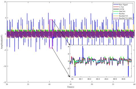 Remote Sensing Free Full Text Noise Attenuation For Csem Data Via Deep Residual Denoising