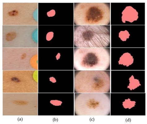 Mathematics Free Full Text Deeplabv3 Based Segmentation And Best