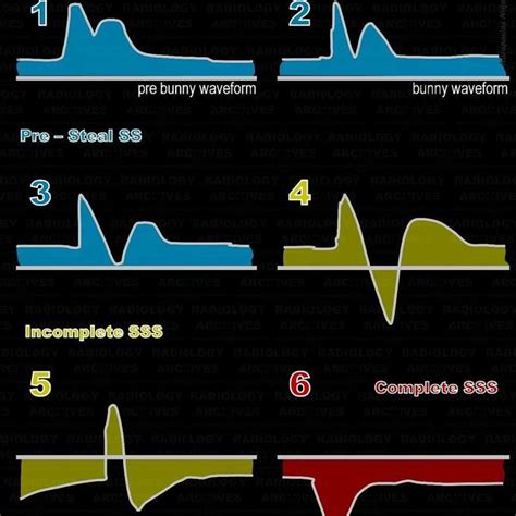 Types Of Waveforms Diagram