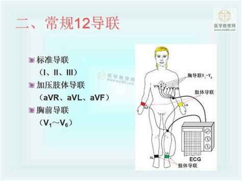 如何迅速完成12心電圖導聯 每日頭條