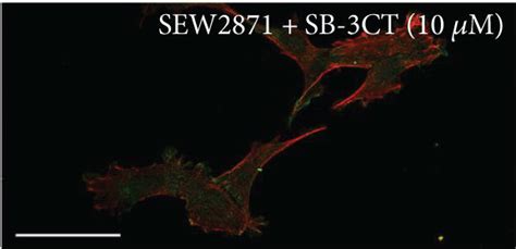 Cytoskeleton Organization And Cortactin Expression Bm Mscs Were