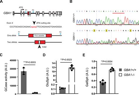 Characterization Of Novel Human β Glucocerebrosidase Antibodies For Parkinsons Disease Research