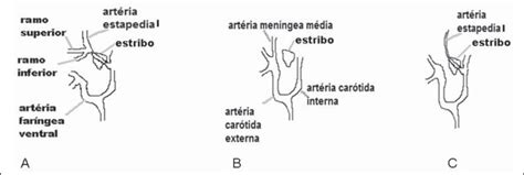 Stapedial Artery And Hyoid Artery