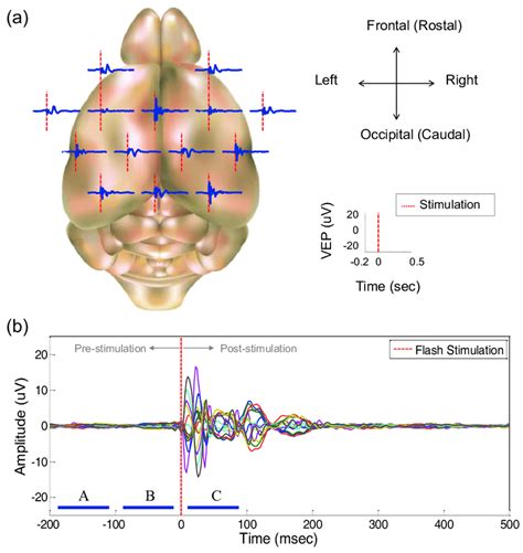Visual Evoked Potential Vep Experimental Results A Grand Averaged Download Scientific