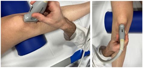 Effect Of Physical Parameters And Training Load On Patellar Tendon