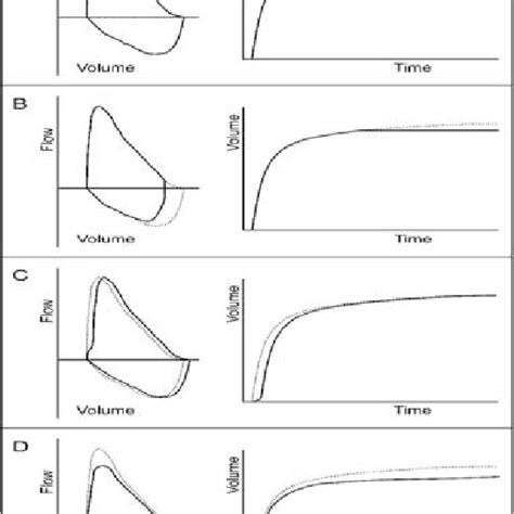 Abnormalities Seen On Flow Volume Loops And Volumetime Curves In Download Scientific Diagram