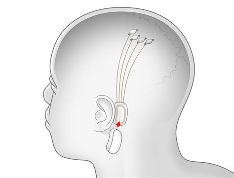 Elon Musk Sets Update On Brain Computer Interface Company Neuralink For