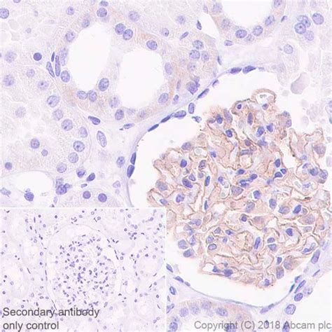 Anti Nphs2 Antibody Epr22203 219 Ab229037 Abcam