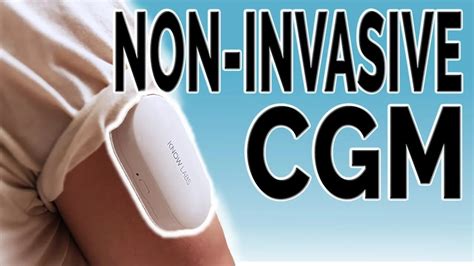 Are Non Invasive Cgms The Future Youtube