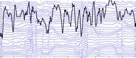 Example Of Dynamic Model Selection Along A Segment Of A Speech Download Scientific Diagram