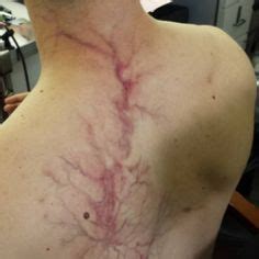 19 Lichtenberg Figures Ideas Lichtenberg Figures Lichtenberg