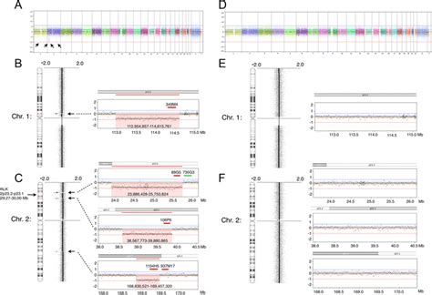 Genome Analysis Using High Resolution 180 K Oligo Based Array CGH Download Scientific Diagram