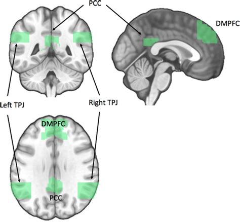 Anatomically Defined Regions Of Interest For The Mentalizing Network Download Scientific