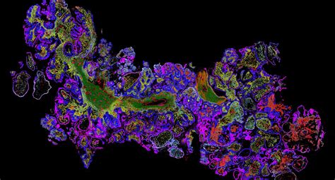 Vizgen Merscope Ffpe Kit