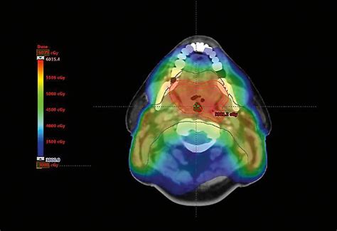 Ent Head And Neck Surgery Mount Sinai New York