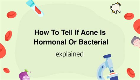 How To Tell If Acne Is Hormonal Or Bacterial