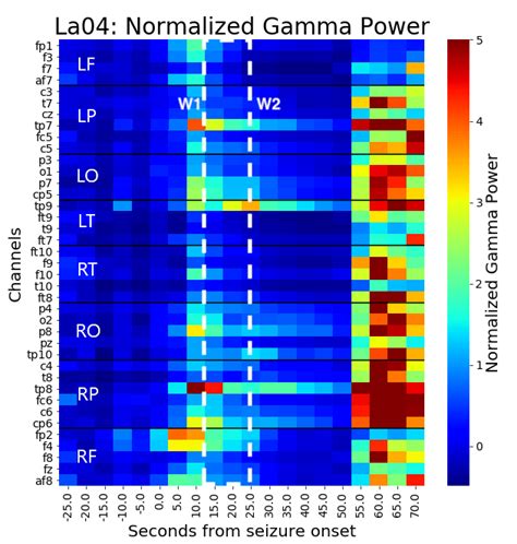 An Example Of The Normalized Gamma Power For Patient Identifier La04 Download Scientific