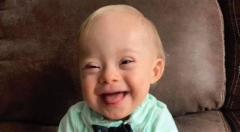 Down Syndrome Popsugar Love And Sex