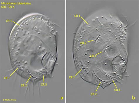 Microthorax Bidentatus Real Micro Life