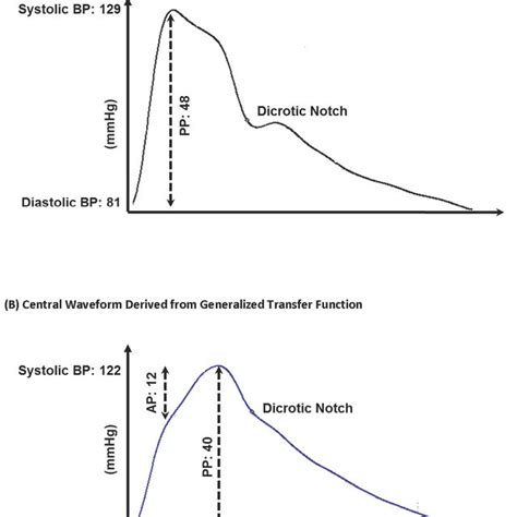Examples Of Peripheral And Central Pulse Waveforms A Waveforms From Download Scientific