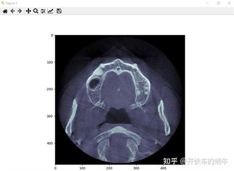 Python Numpy处理dcm三维图像 知乎