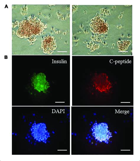 Islet Like Cluster Formation A Dithizone Staining Of Download Scientific Diagram