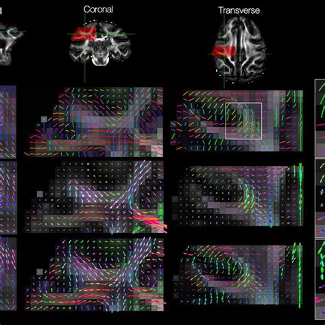 The Hybrid Dmri Pli Fibre Orientations Top Right The Angular Download Scientific Diagram