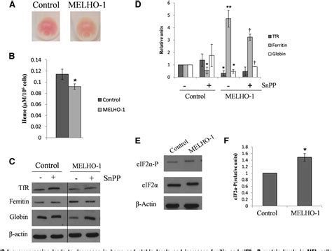 Figure 1 From Heme Oxygenase 1 Is Expressed In Murine Erythroid Cells Where It Controls The