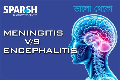 Meningitis Vs Encephalitis Sparsh Diagnostic Center