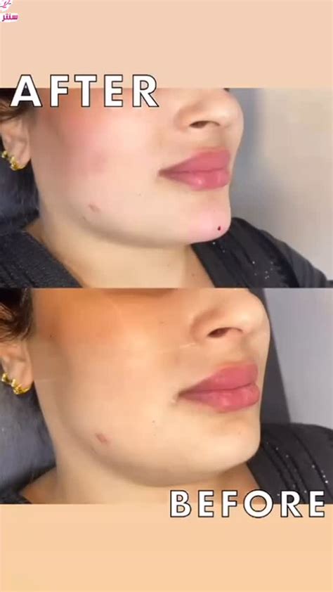 ‎سنتر ريفانا‎ ‎جلشفرنشاكريليكأظافر منيكيربديكير اكرلك‎ Instagram