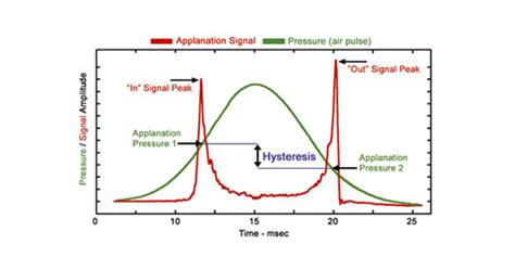 Ocular Response Analyzer Iliasmedicals